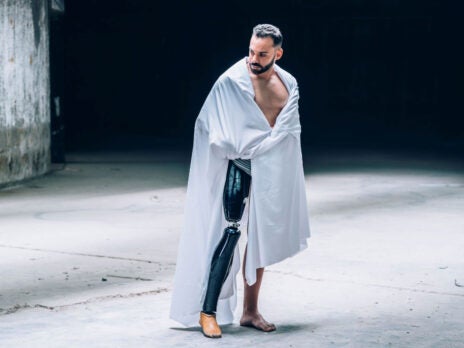 3D printed prosthetic leg socket tracks calories burnt in style - Verdict