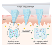 Coin-sized smart insulin patch delivers payload via microneedles | Verdict